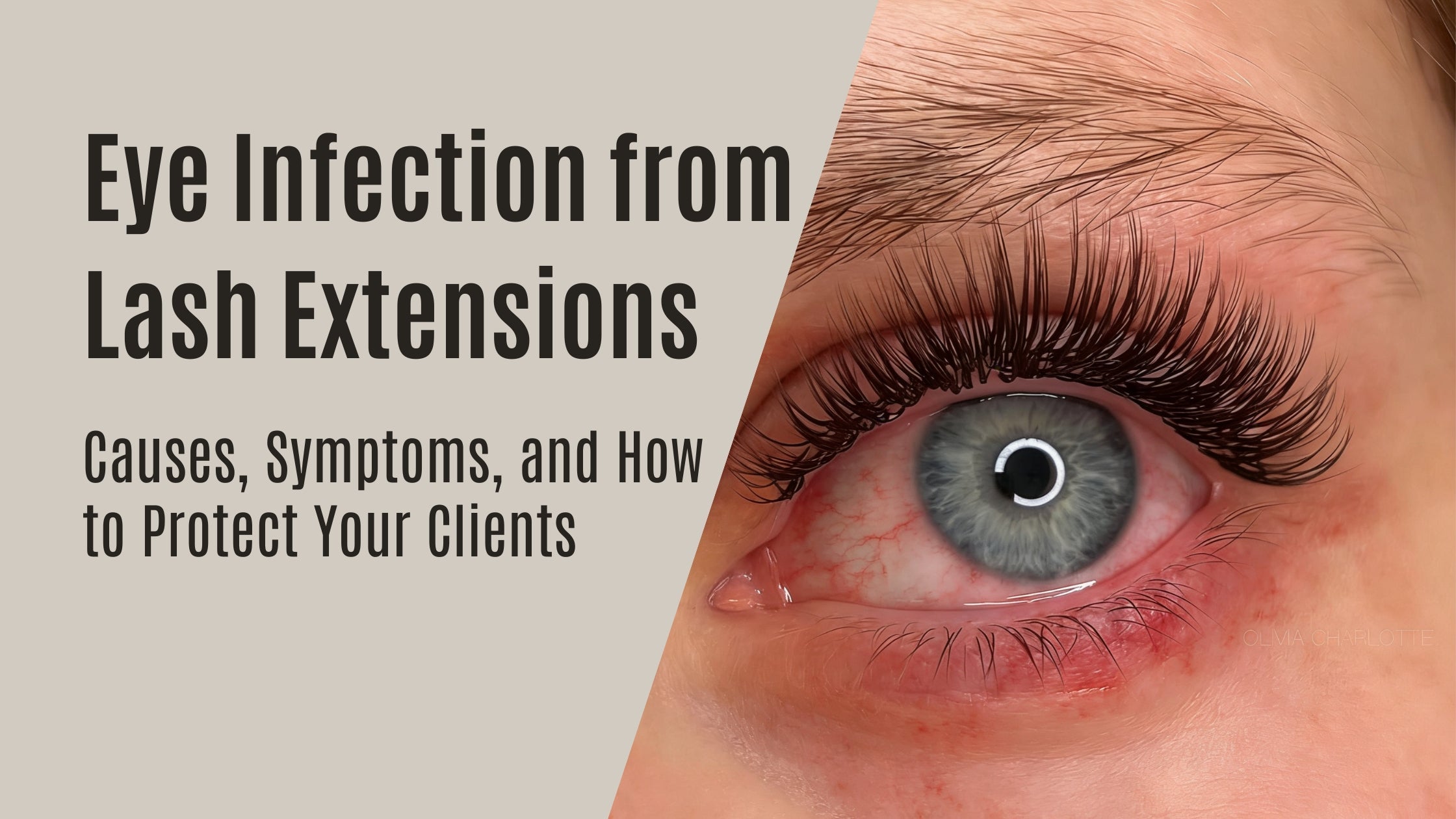 How to Prevent Lash Extension Eye Infections (2026 Guide) – SENSELASHES